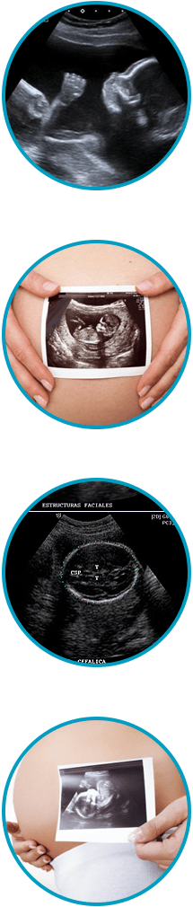 El ultrasonido estructural y la salud de tu bebé